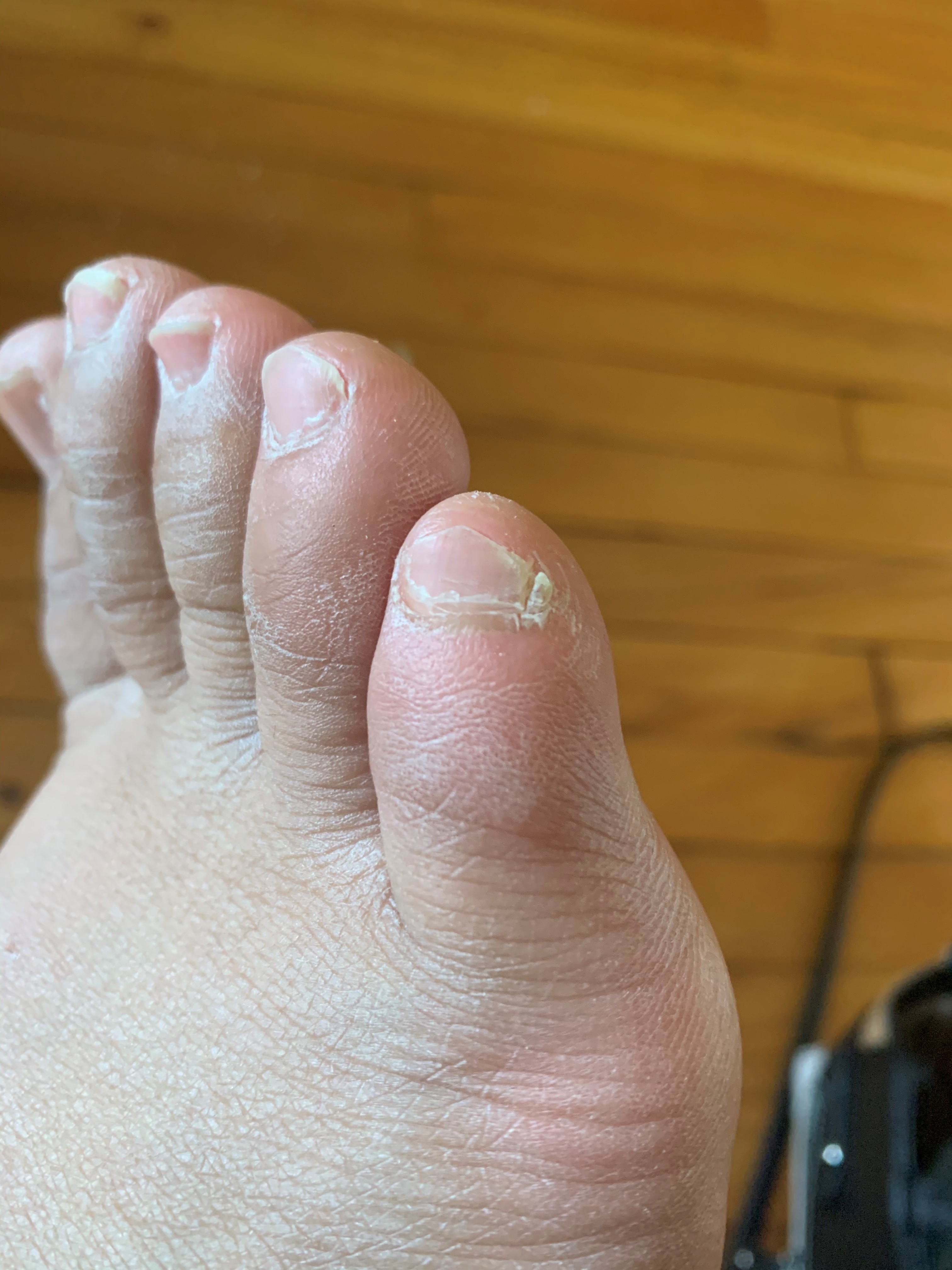 Legends of the Split Pinky Toenail – Stephwaxpoetic