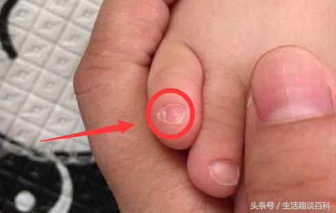 Legends of the Split Pinky Toenail – Stephwaxpoetic